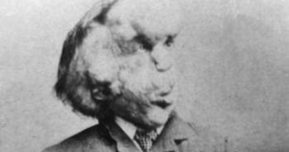 Dr. Treves and the Elephant Man | United Church of God